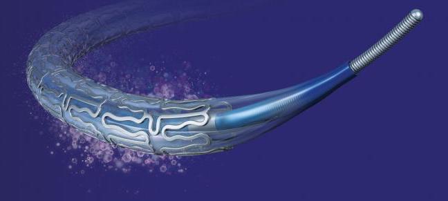 What is a stent? – Australian Heart